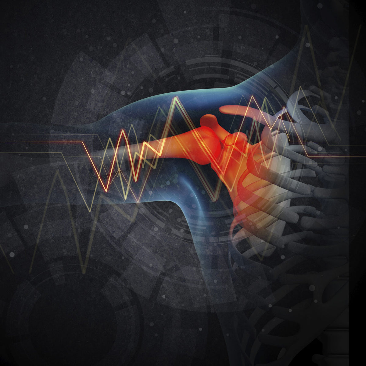 Why Powerlifters Should Train Their Shoulders – EliteFTS